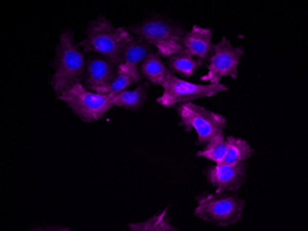 MOC1 Mouse Oral Squamous Cell Carcinoma (OSCC) Cell Line | SCC469